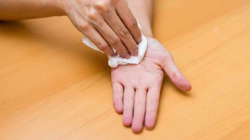 Sweaty Palms Surgery Singapore Risks Benefits Side Effects